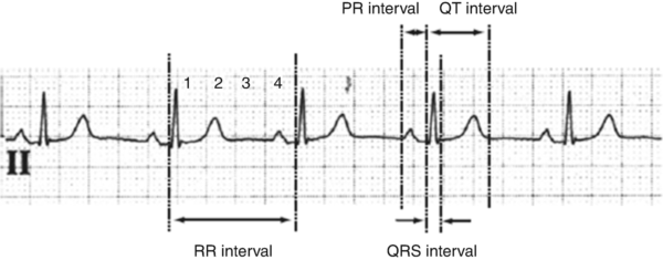 EKG Part 3 : Elektrokardiogram Normal – DIFUSI REVIEW